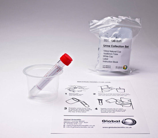 Primary urine collection kit with boric acid